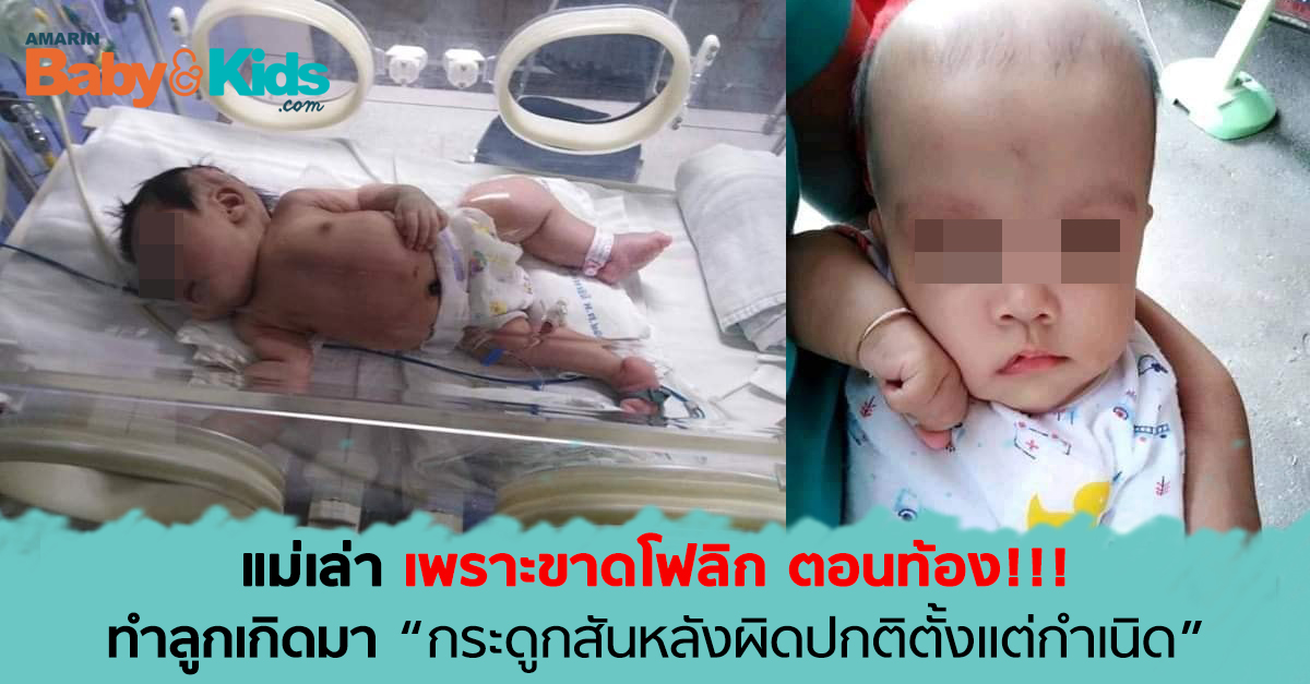 ขาดกรดโฟลิก ตอนท้อง ลูกเกิดมาจะพิการแต่กำเนิดจริงรึ? - Amarin Baby & Kids