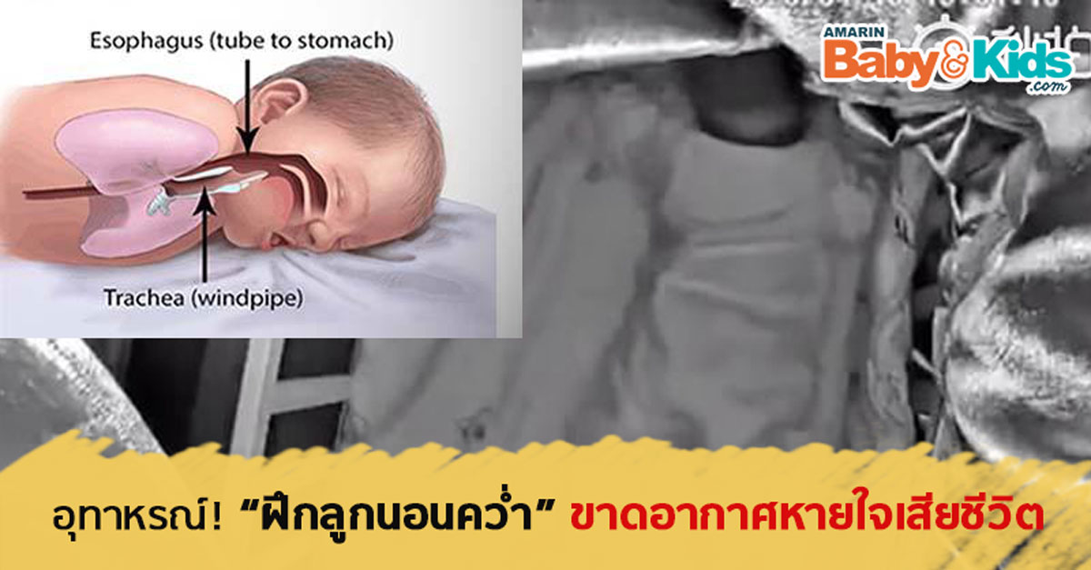 “ฝึกลูกนอนคว่ำ” อันตราย! เสี่ยงขาดอากาศหายใจ - Amarin Baby & Kids