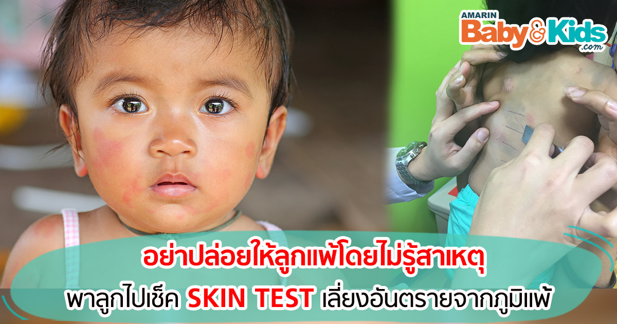 รวมโรงพยาบาลทำ Skin Test พาลูกไปเช็คว่าแพ้อะไร - Amarin Baby & Kids