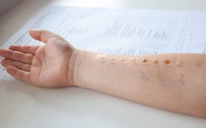 รวมโรงพยาบาลทำ Skin Test พาลูกไปเช็คว่าแพ้อะไร - Amarin Baby & Kids